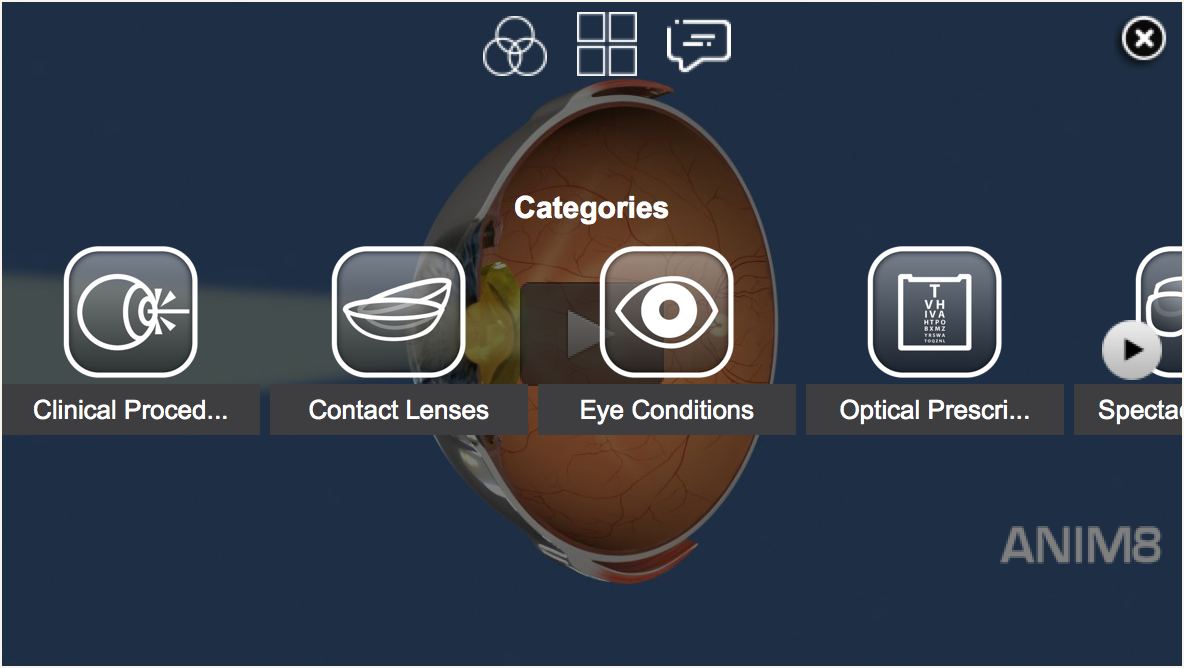 Ophthalmology Animations for Websites | OPTIMED