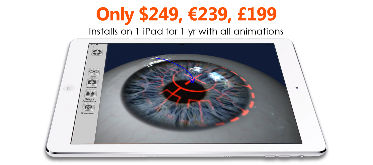 Eye App for Patient Education | EyeDraw