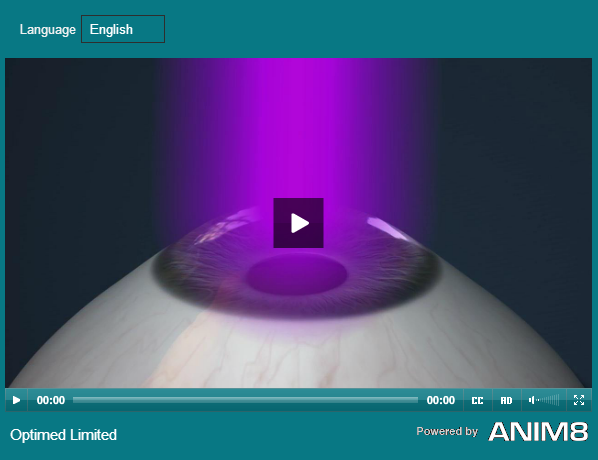 Ophthalmology Animations for Websites | OPTIMED