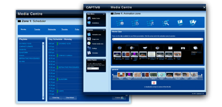 Ophthalmology Animations | Patient Education & Marketing by OPTIMED
